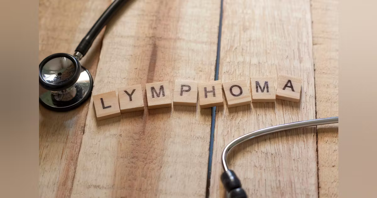Lymphoma Treatment in the UK: Advanced Care for Patients from Russia ...