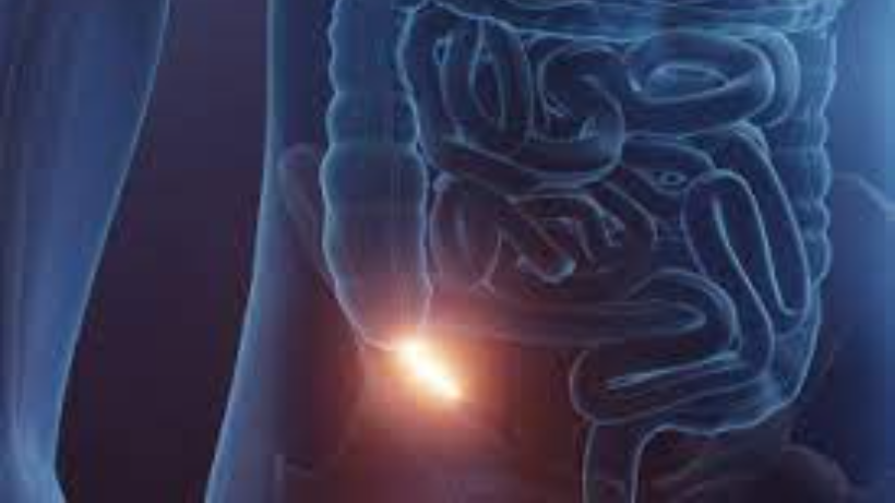 Understanding the Appendix's Role: Debunking Regrowth Myths | HealthTrip
