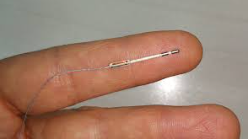 Nerve Stimulation: Advancing Pain Management & Neuro Recovery | HealthTrip