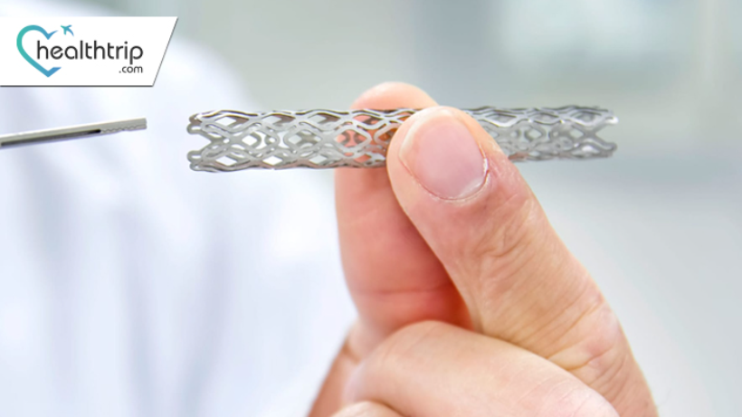 The Role of Stents in PTCA Procedures | HealthTrip