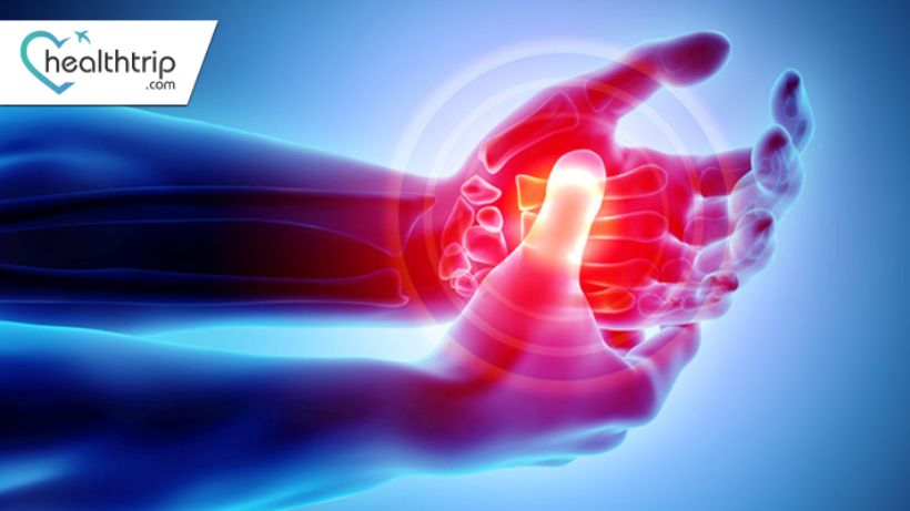 Understanding Arthritis: Symptoms, Causes, and Treatments | HealthTrip